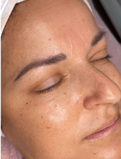 Hydra Touch H2 | Devices | Sculpt Pro Aesthetics